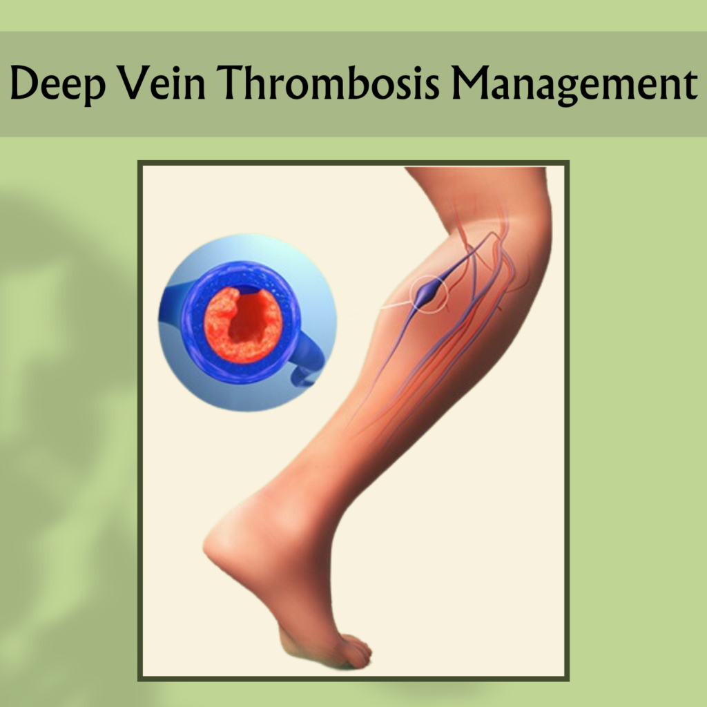 Deep Vein Thrombosis Management – Elegance Podcast